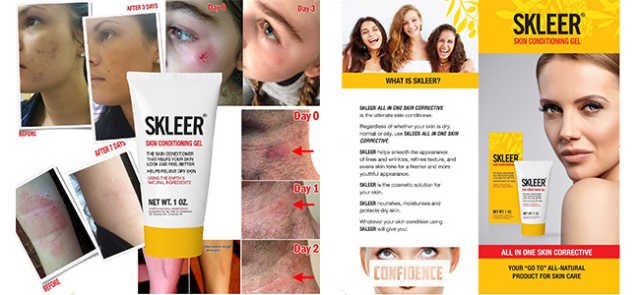 Skleer Review - Revitalize Your Skin with a Miracle Gel.